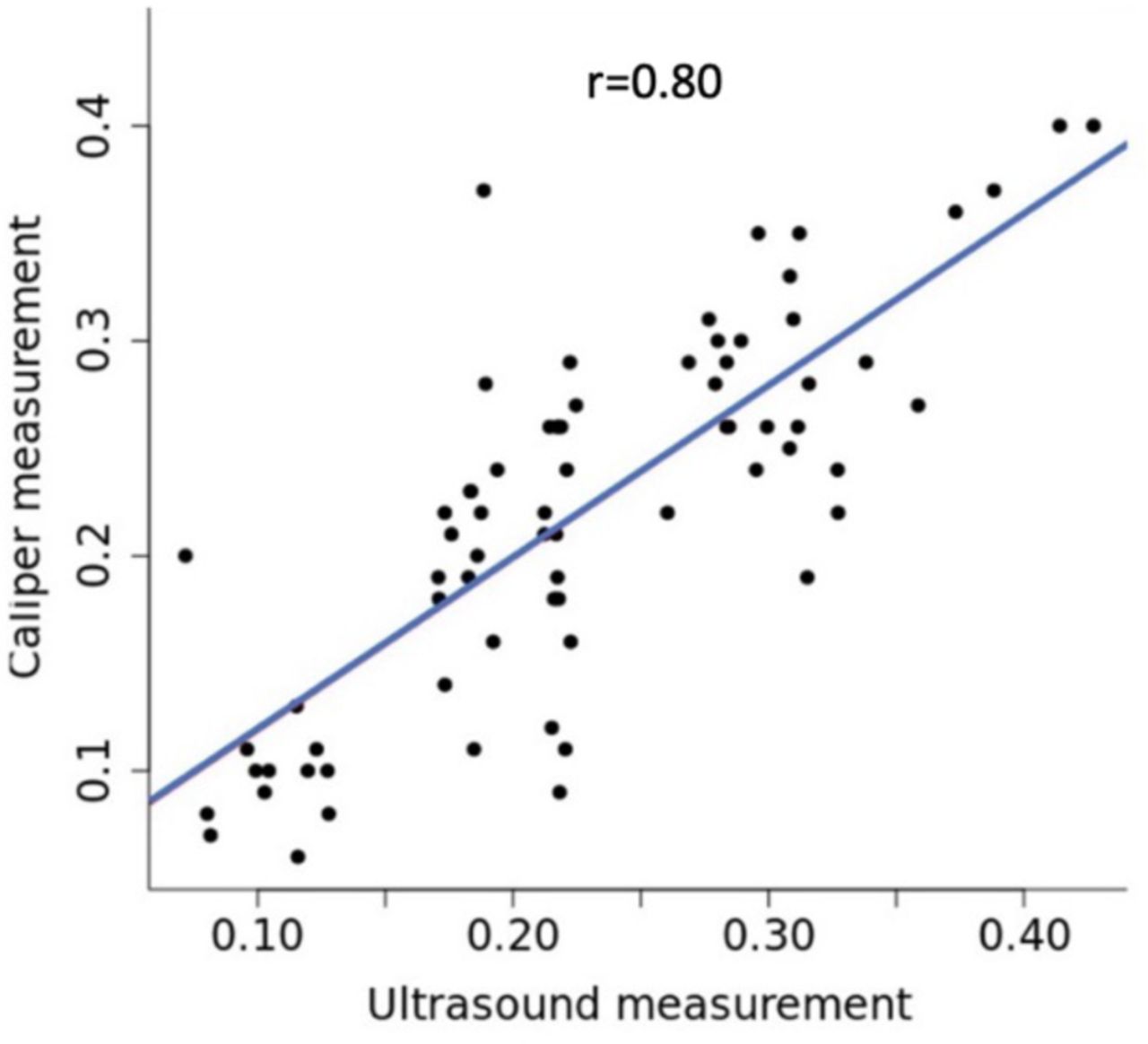 Ultrasonographic study of the thumb pulleys and their entheses ...