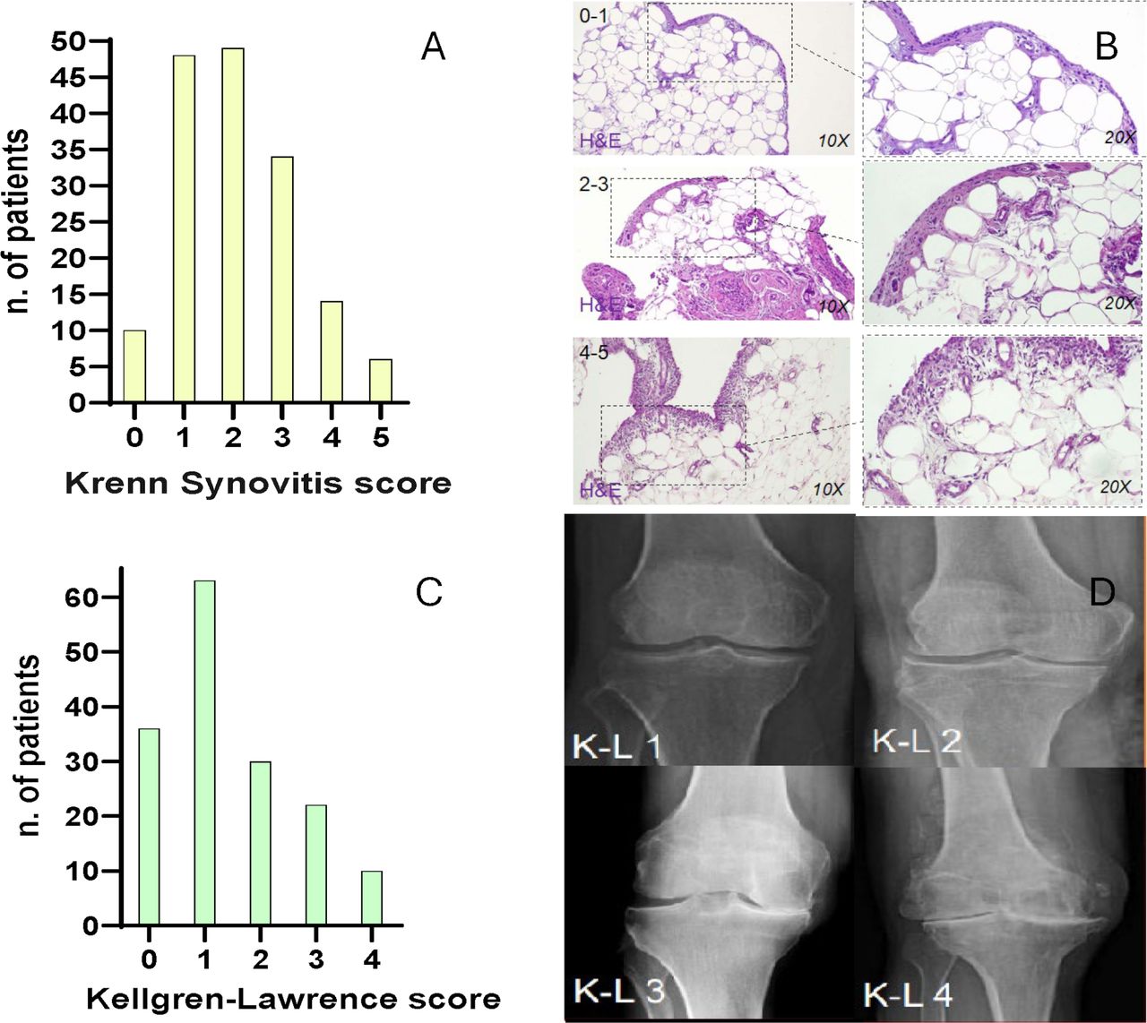 Histological synovitis and radiographic damage in knee osteoarthritis ...