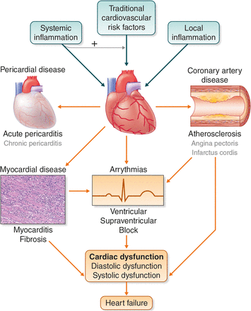 Cardiac involvement in adult and juvenile idiopathic inflammatory ...